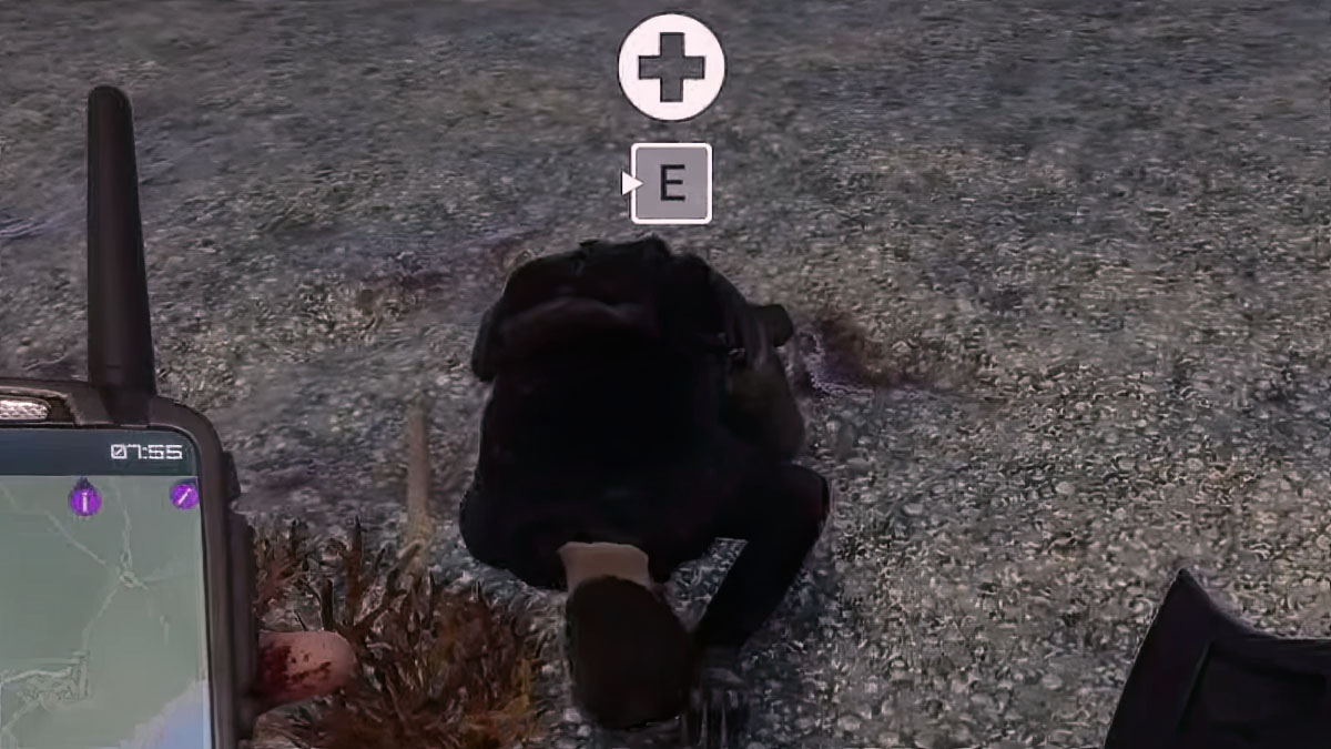Sons Of The Forest How To Heal Kelvin Can He Die And Can You Bring