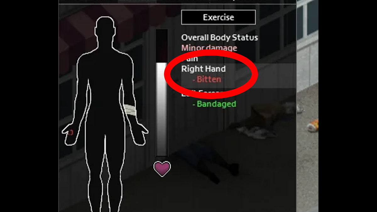 Project Zomboid Infection: Is There a Way To Prevent Becoming a Zombie ...